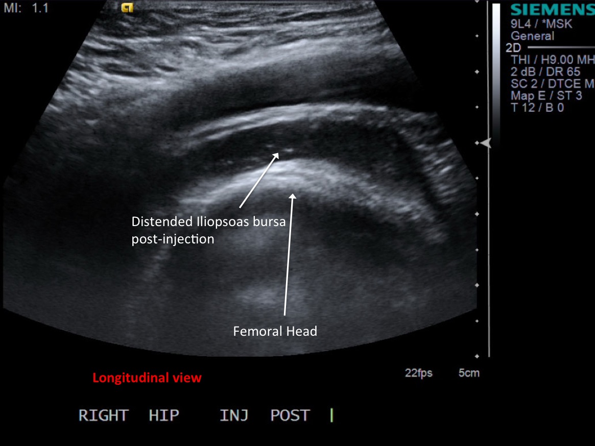 MSK Ultrasound Procedures